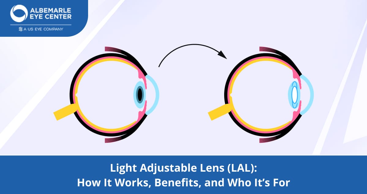 Light Adjustable Lens (LAL) | Advanced Cataract Surgery Option